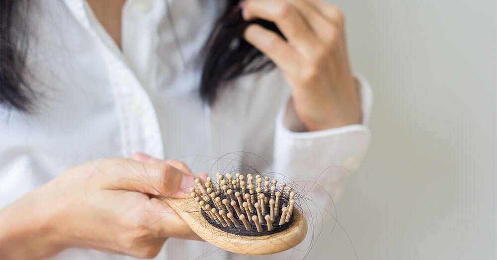 Haarausfall bei Frauen: Ursachen, Symptome und Arten